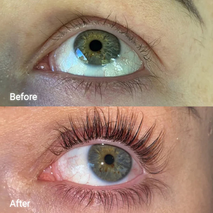 ForLash | Eyelash Growth Enhancing Serum by ForChics