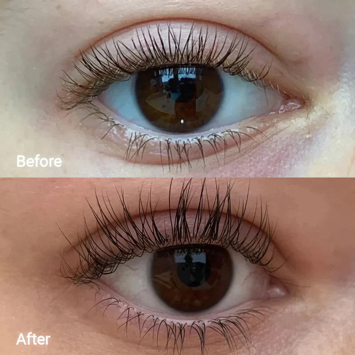 ForLash | Eyelash Growth Enhancing Serum by ForChics